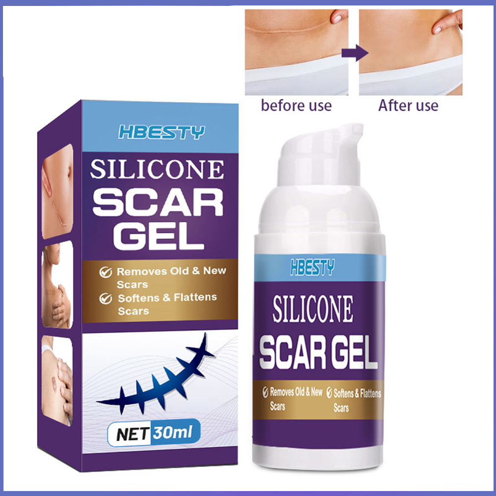 Effective on Old & New Scars DM Scar remover cream Scar remover for ...