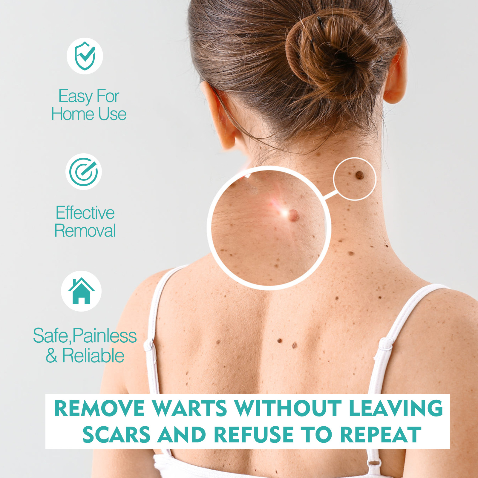 Warts Kasoy Remover Cream Skin Tag Mole Cream Remover original Warts ... Warts Kasoy Remover Cream Skin Tag Mole Cream Remover original Warts ...