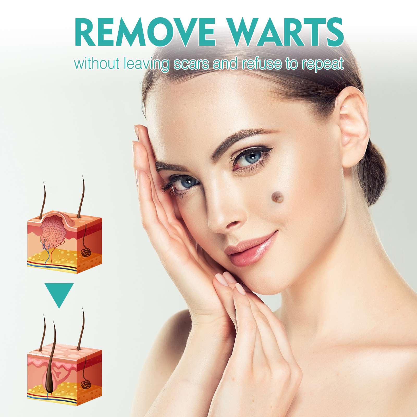 Warts Kasoy Remover Cream Skin Tag Mole Cream Remover original Warts ... Warts Kasoy Remover Cream Skin Tag Mole Cream Remover original Warts ...