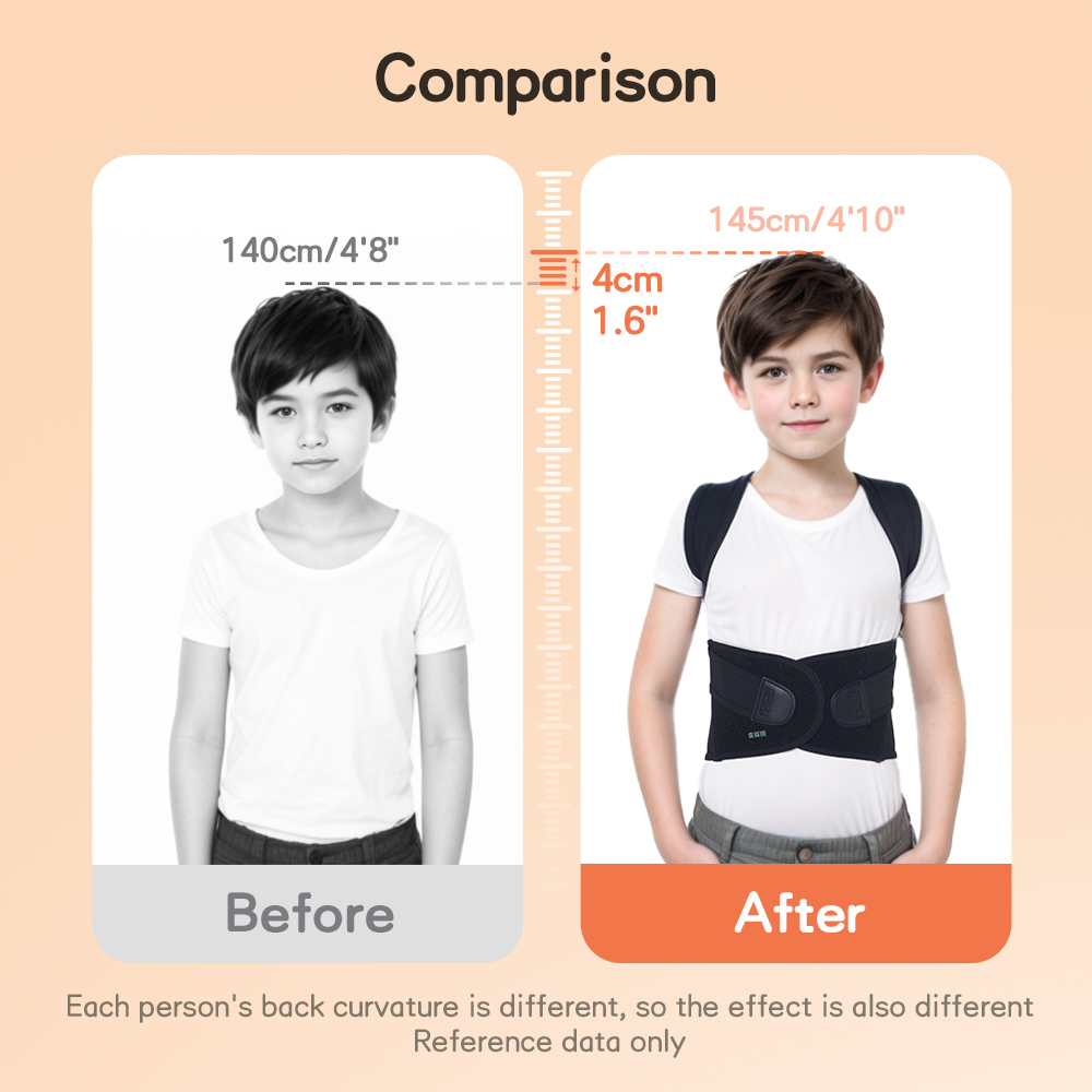 BABAKA Children Back Brace Support Orthopedic Belts Breathable Therapy ...