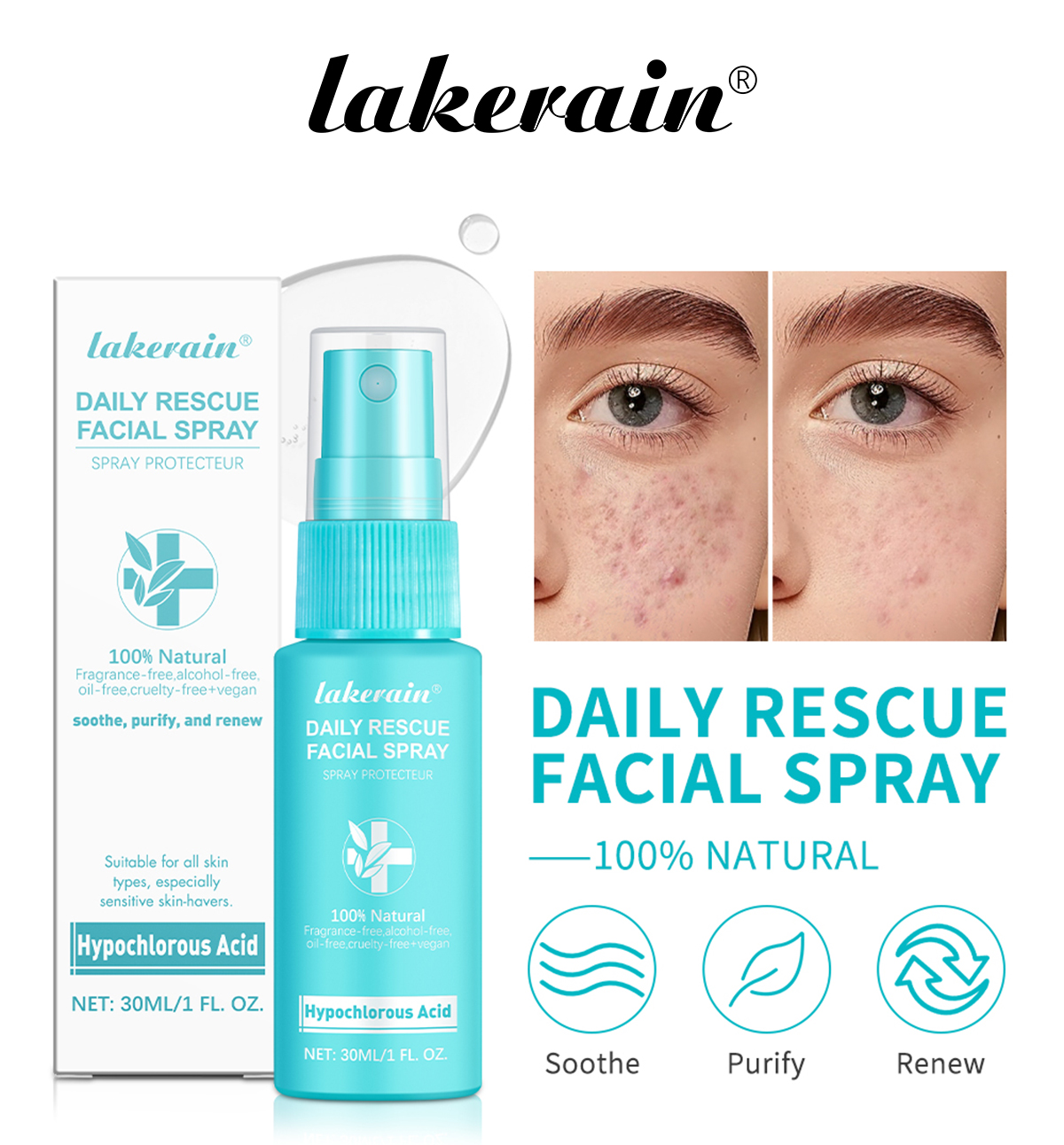 Lakerain 30ml Daily Rescue Facial Spray for Sensitive Skin,Helps Reduce ...
