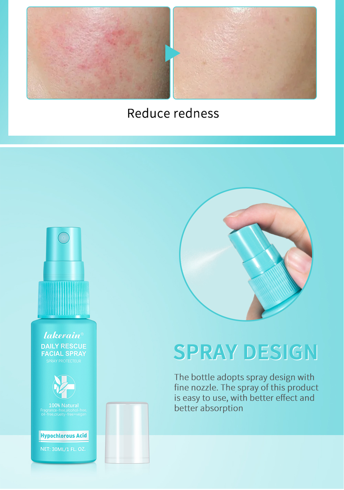 Lakerain 30ml Daily Rescue Facial Spray for Sensitive Skin,Helps Reduce ...