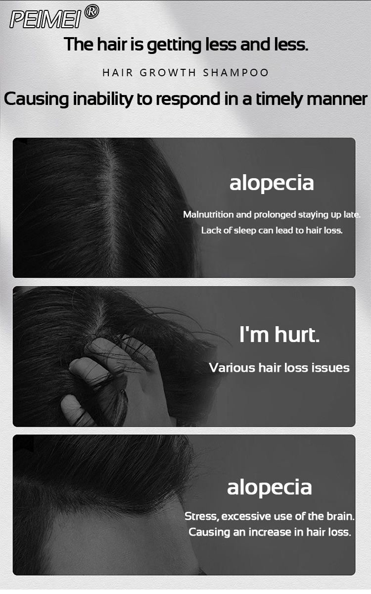 【Genuine】Ginger Shampoo, Anti-Hair Loss Hair Growth Formula, Repair ...