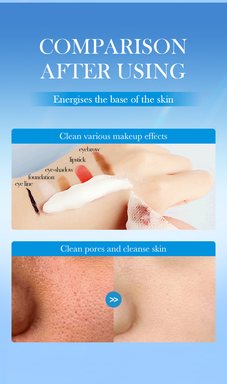 SD 8D Hyaluronic Acid Cleanser Gentle Oil Control Cleansing Mousse ...