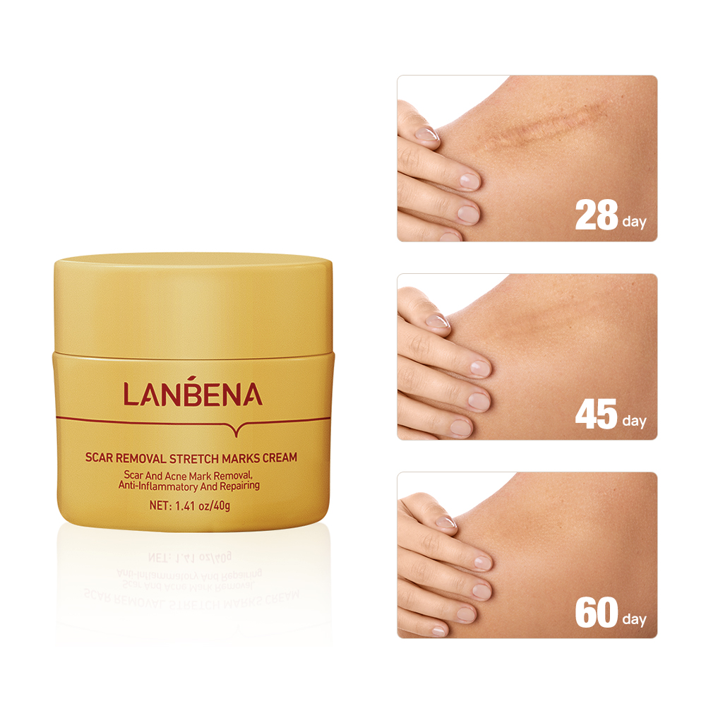 LANBENA Scar Remover Gel Acne Treatment Stretch Mark Remover Whitening ...