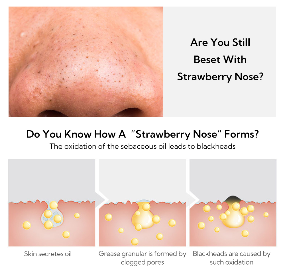 LANBENA Blackhead Remover Nose Strips Bamboo Charcoal Facial Peeling ...