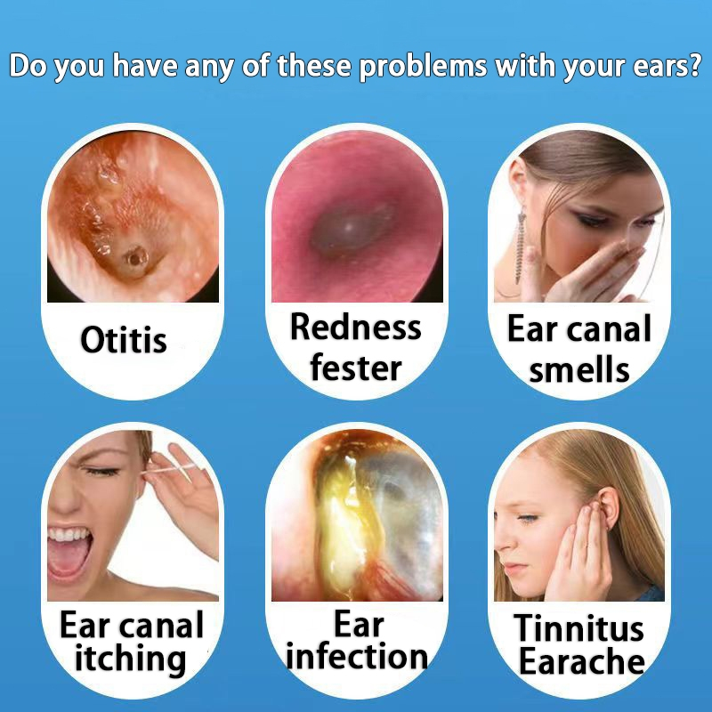 Tinnitus liquid Ear Drops Treatment Original Liquid Ear Pruritus ...