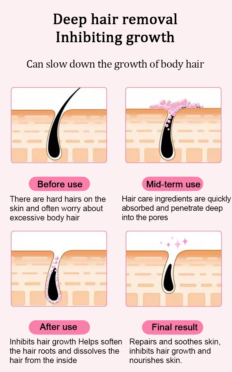 【Fast shipping】Hair Removal Mousse Spray – Suitable for Men & Women ...