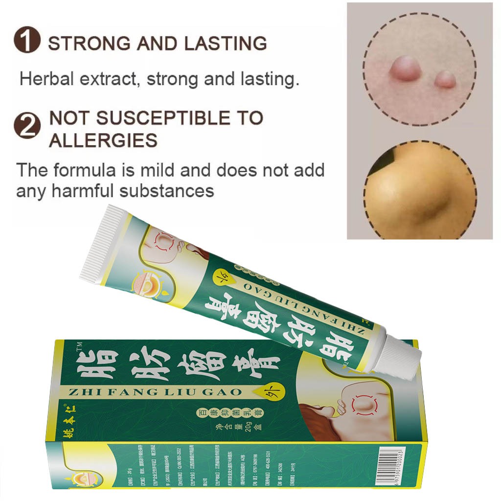 Lipoma Removal Cream Original Japan Bukol Treatment Tumor Skin Swelling ...
