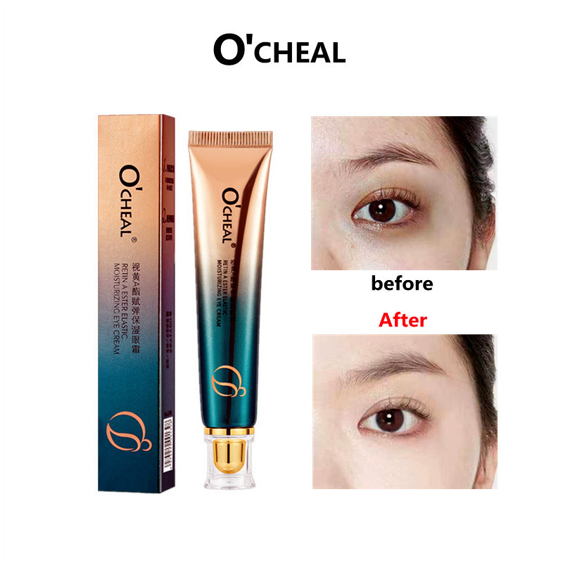 Eye Cream for Dark Circles and Puffiness Anti Aging Reduce Fine Lines ...