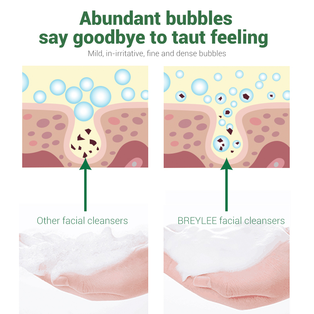 Breylee Acne Treatment Set Acne Skin Care Set Scar Treatment Face Serum Face Cleanser Cream ...