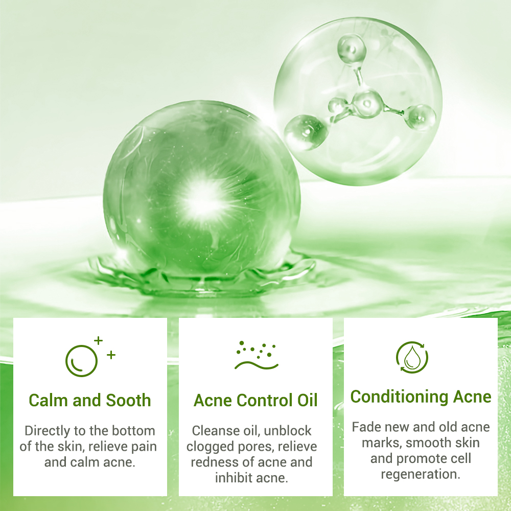 Breylee Acne Treatment Set Acne Skin Care Set Scar Treatment Face Serum Face Cleanser Cream ...