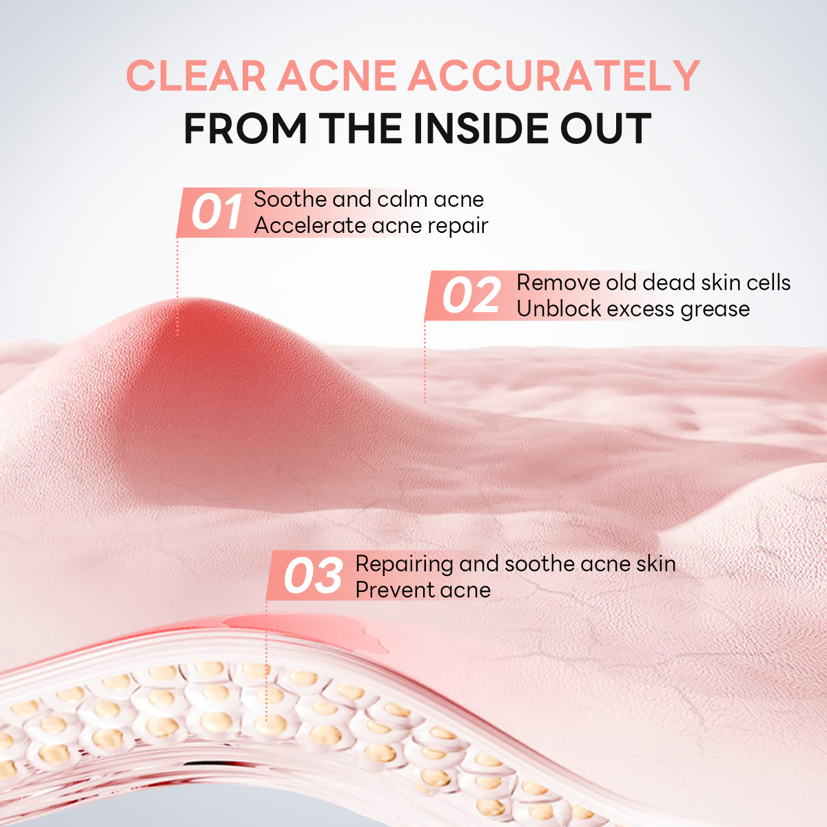 [buy 1 take 1]PAPA FEEL Acne Net Acne Essence Salicylic Acid Anti-acne ...