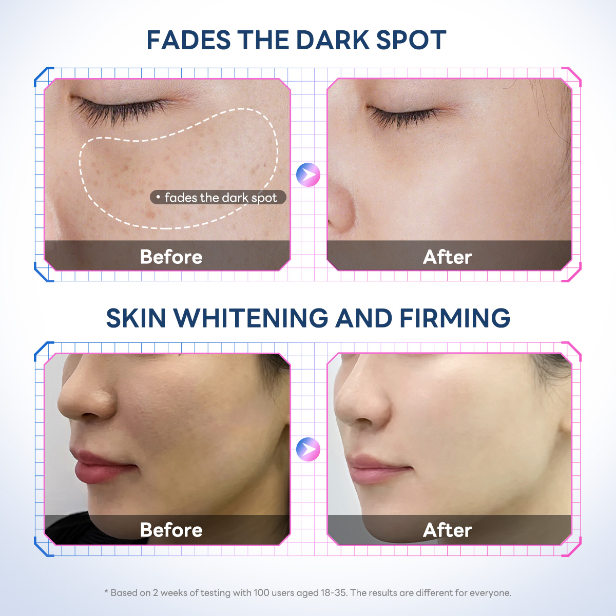 PAPA FEEL【Serum Skin Care Set】577 Dark Spot Brightening Essence 30ml ...