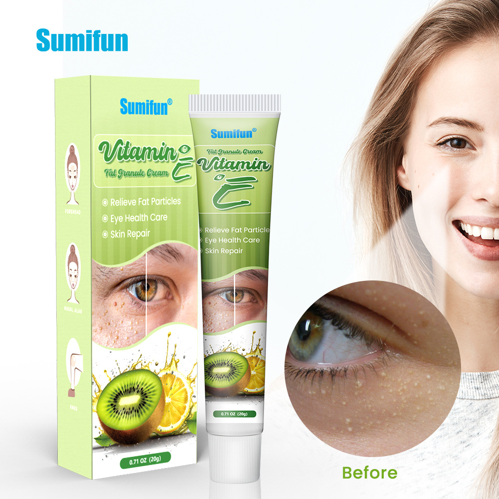 20g Fat Granule Cream Vitamin E Milia Seed Remover Eye Cream Syringoma ...
