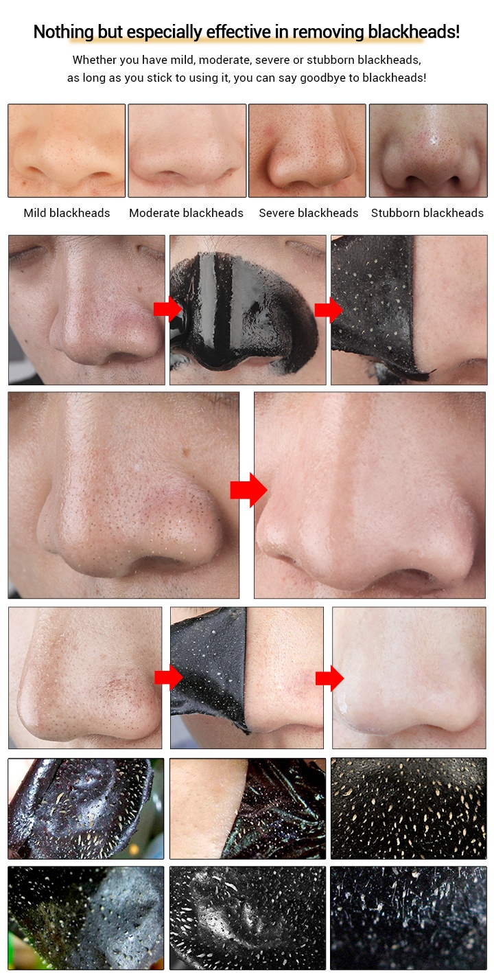 Single-piece Peel-off Nose Mask in Smear-on Type for Removing ...