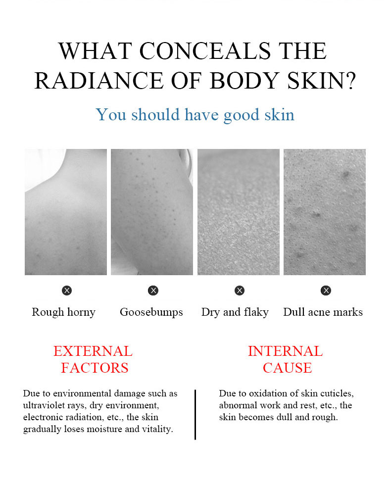 Lady BEGIN Niacinamide Body Lotion Whitening Cream-Moisturizing ...