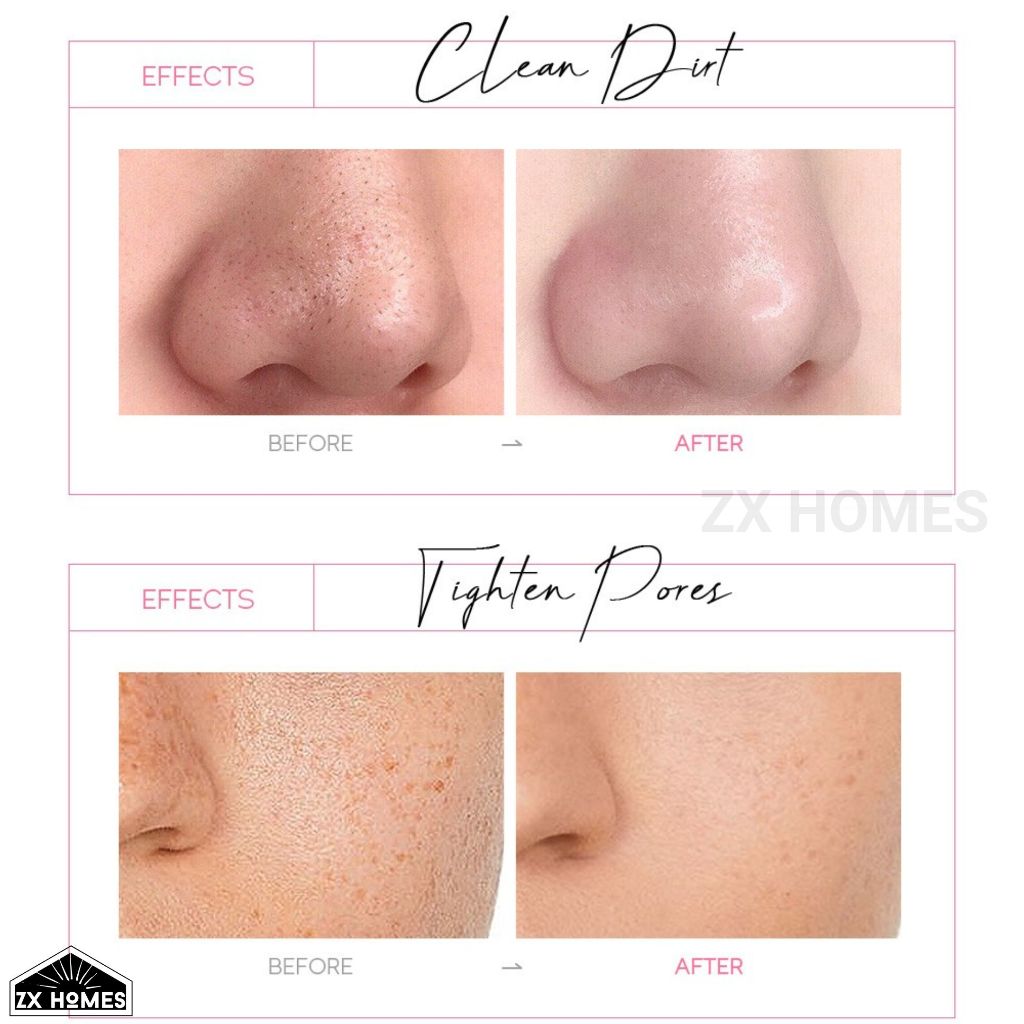 100ml SkeenCare Peeling Feeling Lotion Original BUY 1 TAKE 1 | Shopee ...