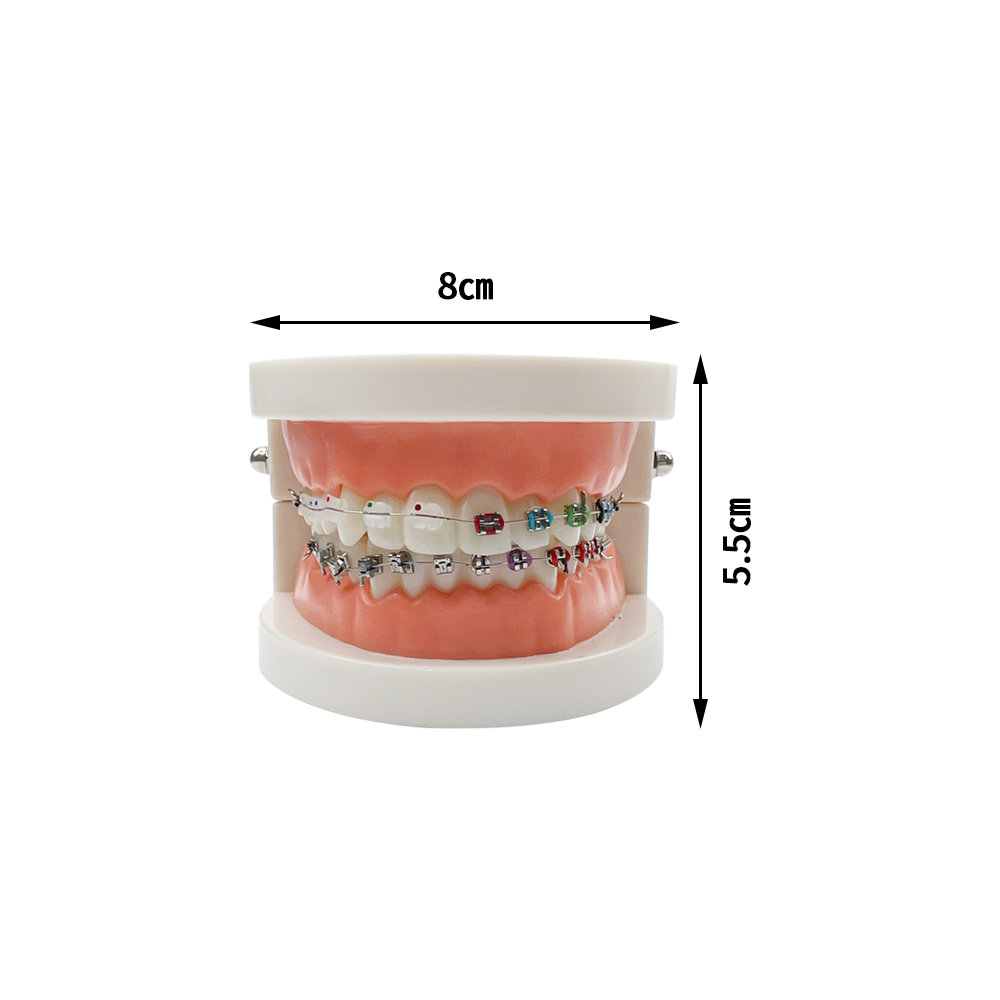 1Pcs 1/4 Self-Locking Dental Orthodontic Treatment Teeth Model With ...