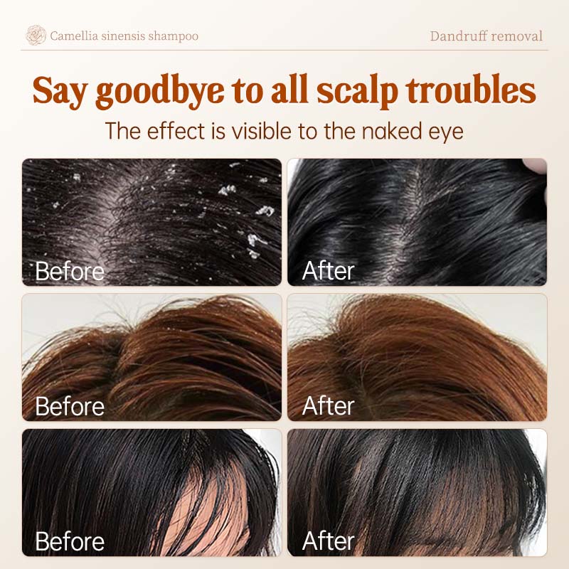 Japan Herbal Hair Shampoo Oil Control Anti-Dandruff Shampoo For Flake ...