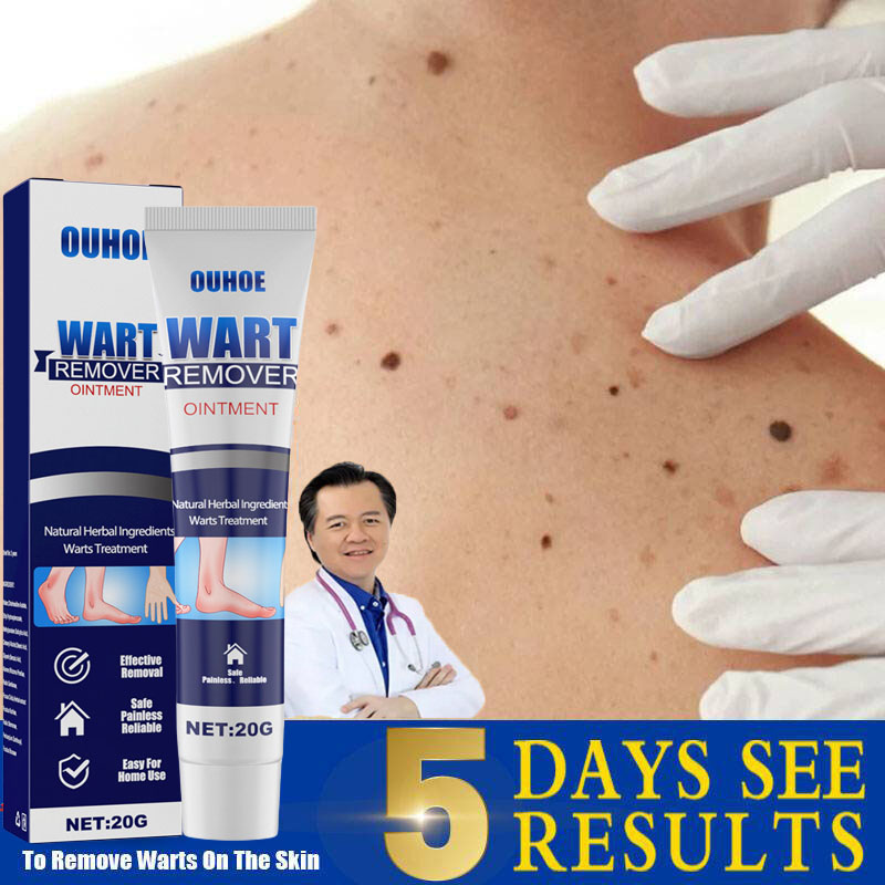 Wart Removal Cream Painless wart remover cream Mole remover Warts ...