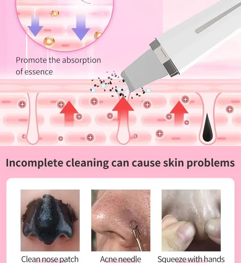 ION Face Deep Cleaning Ultrasonic Skin Scrubber Fast Blackhead Remover ...