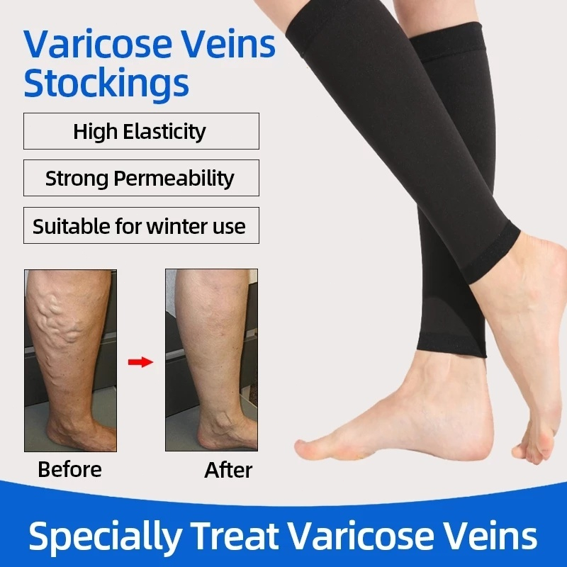 Varicose Stockings Thigh Open Toe Compression Socks Men Women Varicose ...