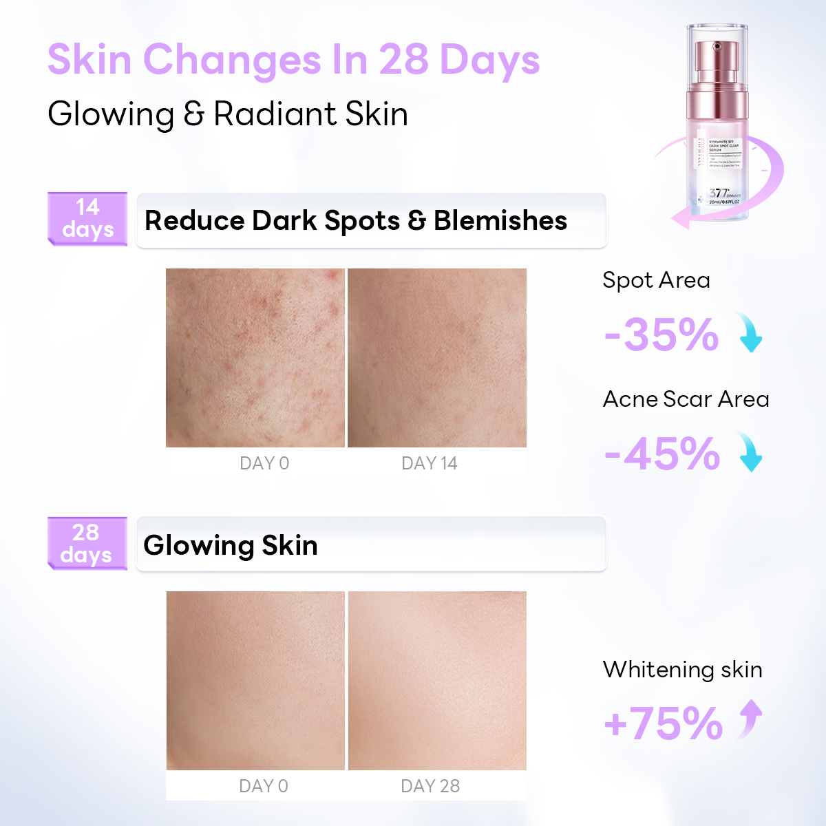 PAPA FEEL【Dark Spot Serum Set】577 Fade Dark Spot Fade Acne Essence 30ml + Symwhite 377 Whitening ...