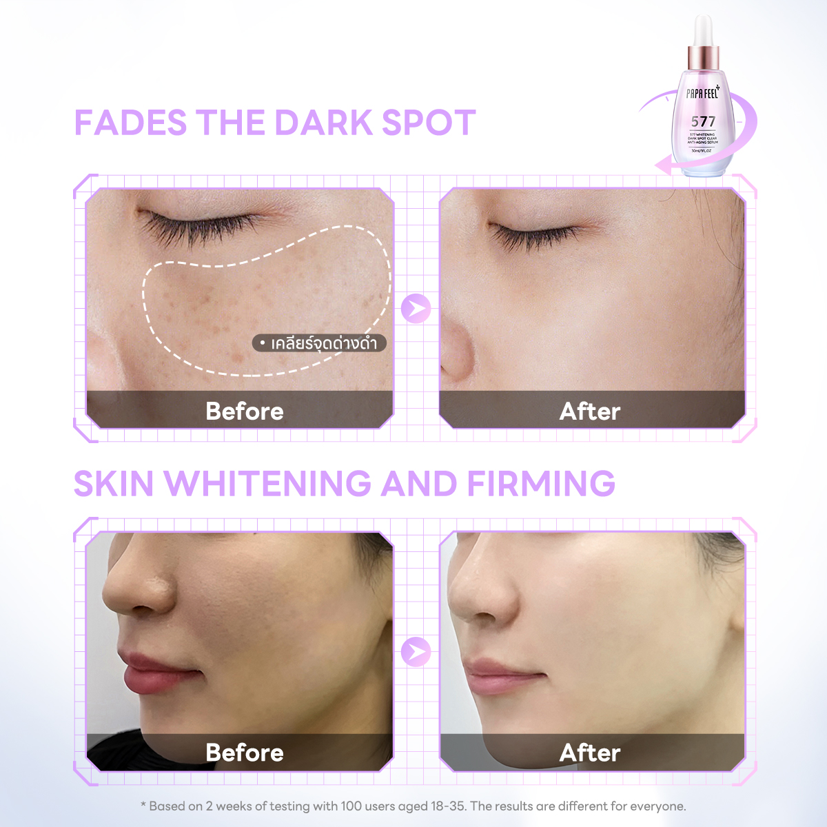 PAPA FEEL【Dark Spot Serum Set】577 Fade Dark Spot Fade Acne Essence 30ml + Symwhite 377 Whitening ...