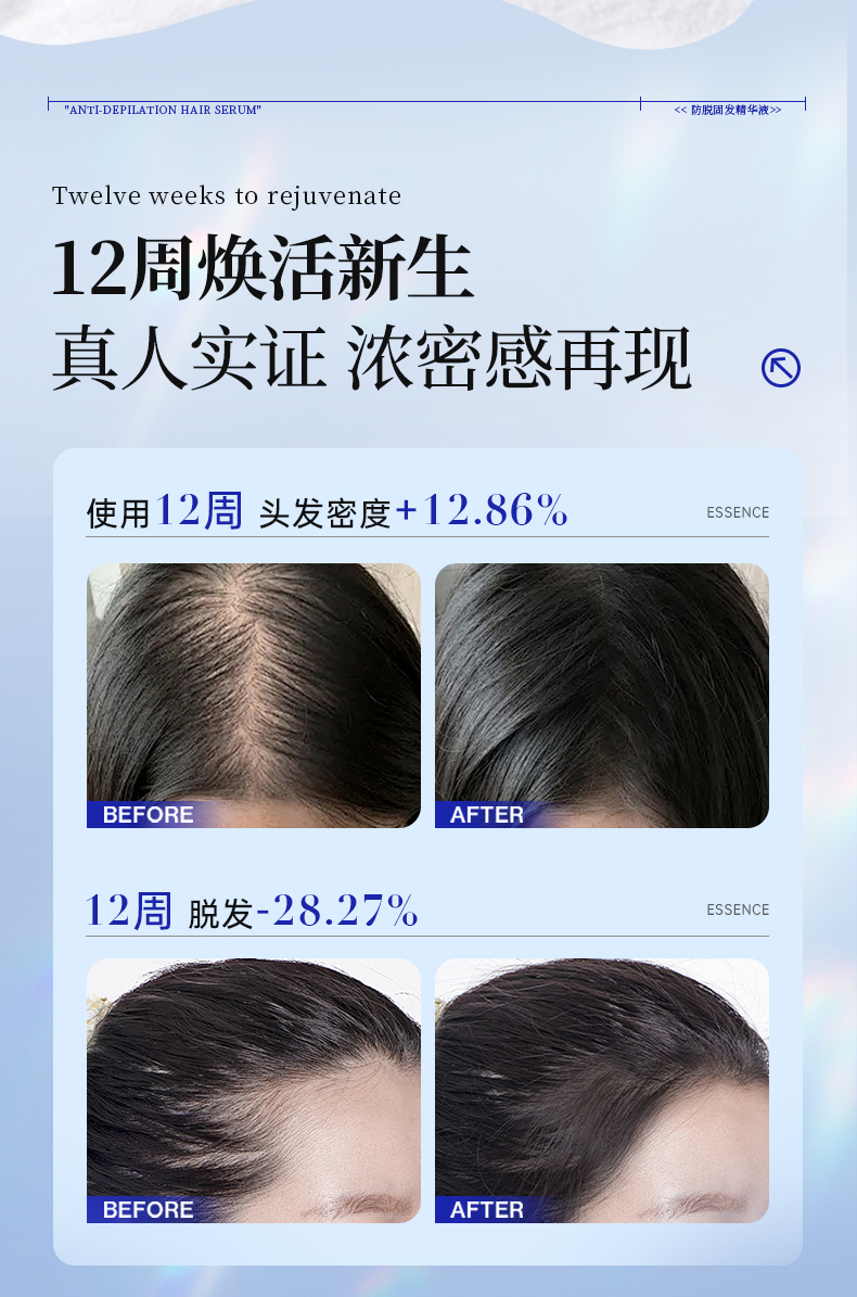 Ehd Anti-shedding Essence Strong Hair Care Hair Strengthening Herbal ...