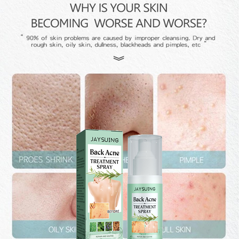 salicylic acid acne spray 2% spray for acne and pimples smooth skin ...