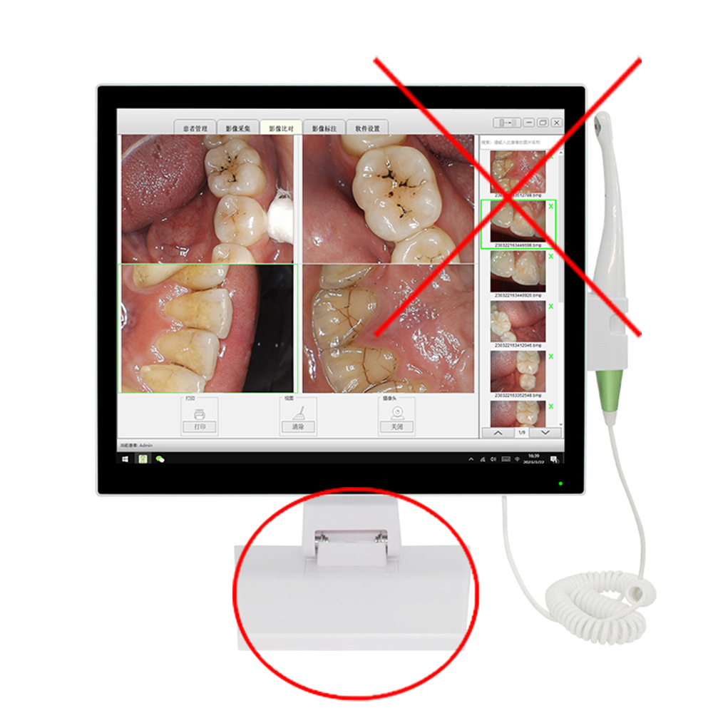 17/24 inch Dental Chair Bracket Touch Screen Monitor Dental INTRA ORAL ...