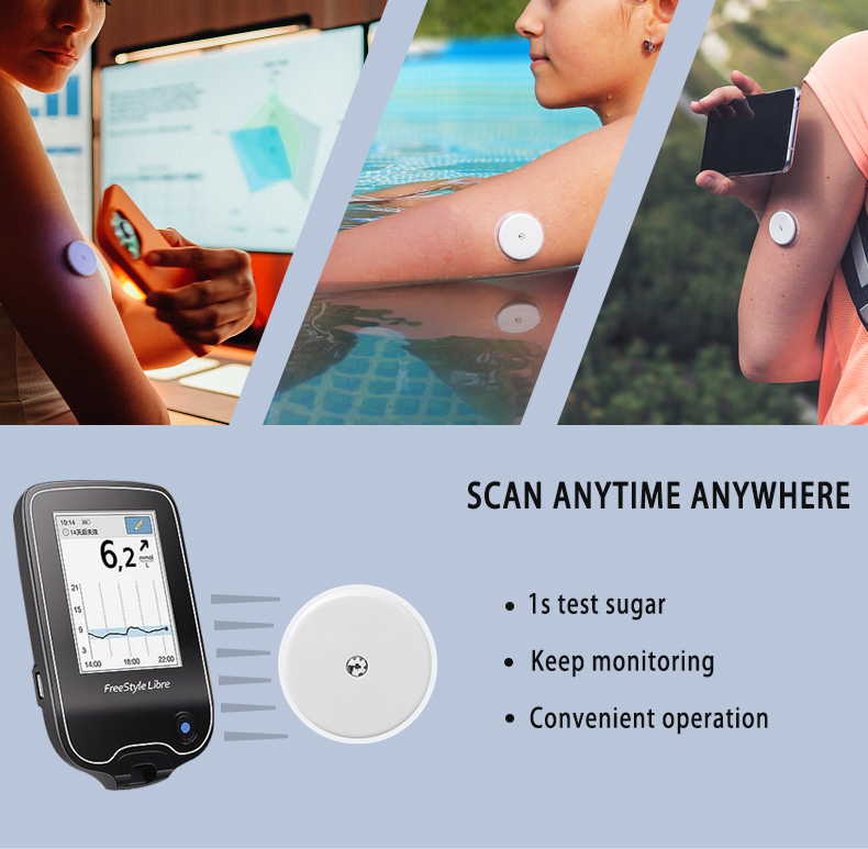 Freestyle Libre 24-hour real-time monitoring blood glucose sensor ...