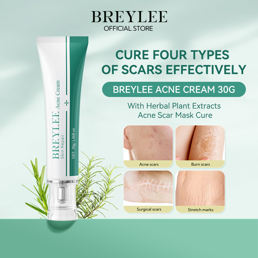 Breylee Scar Acne Cream Acne Treatments Scar Remover Cream Acne Repair Stretch Mark Acne Scar ...