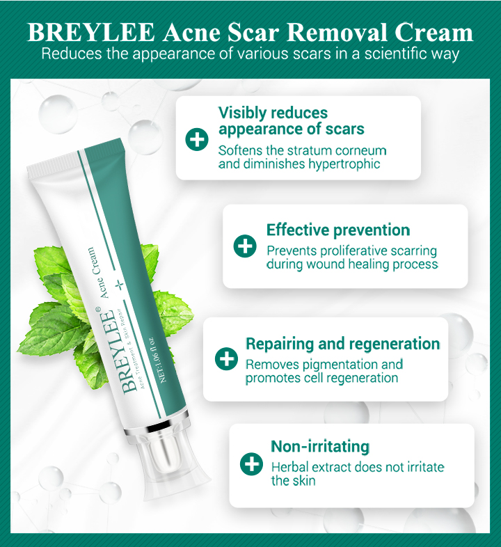 BREYLEE Scar Repair Acne Scar Removal Cream Stretch Mark Acne Treatments Fade Marks Gel Acne ...