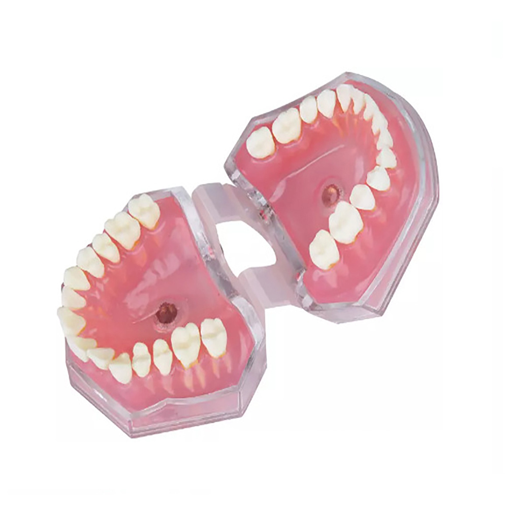 Dental Teeth Model Removable teeth Dental Model With Removable Teeth ...