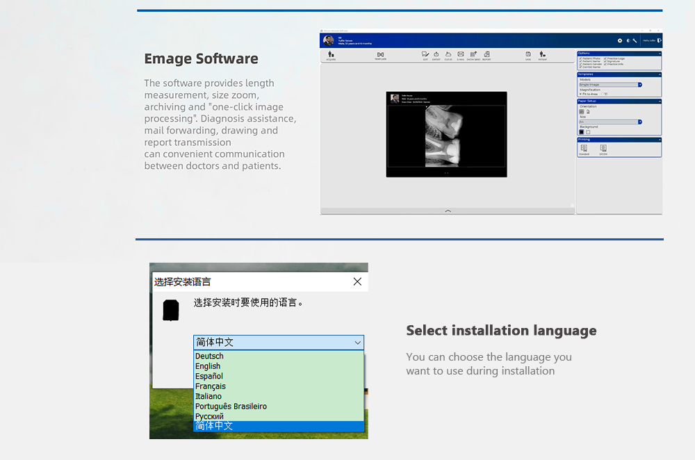 Hot Intraoral Imaging System Digital Dental Sensor X-Ray Rvg Image ...