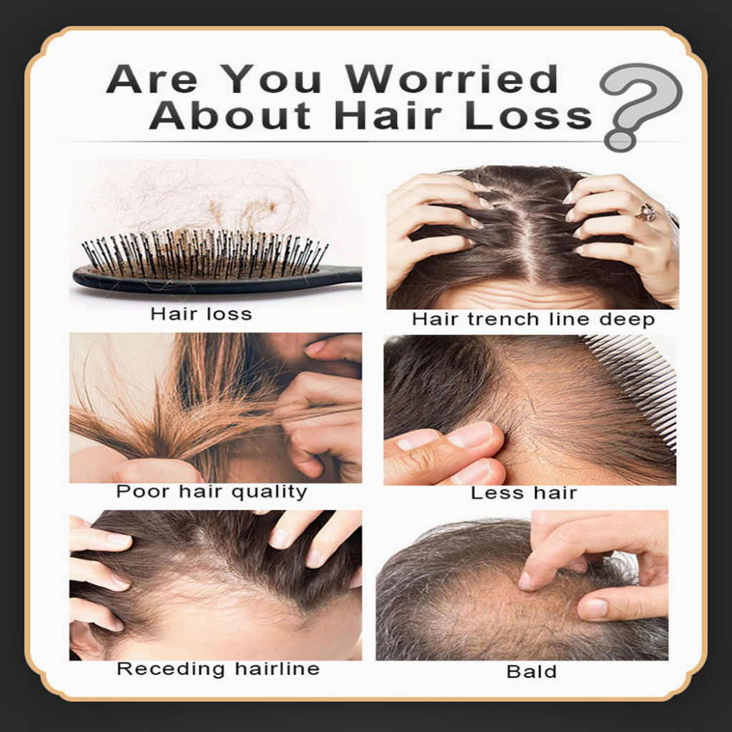 Minoxidil 15% Hosoku Hair Growth(with collagen and castor oil) Hair ...