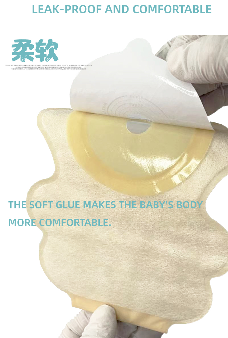 10PCS Children Colostomy Bag, Size 15-40mm Baby mini Ostomy Bag ...