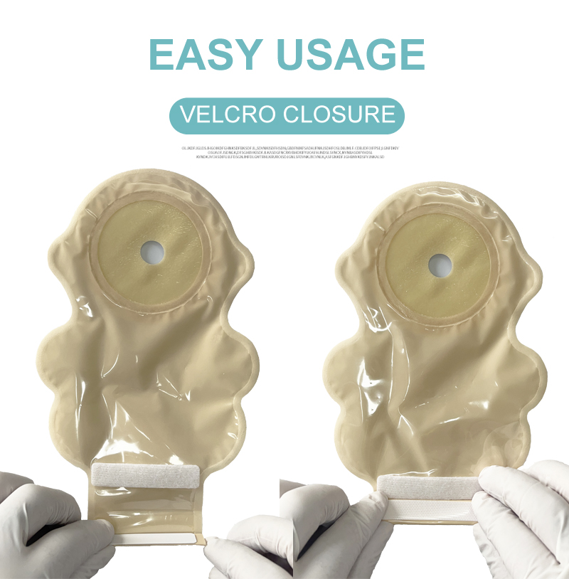 10PCS Children Colostomy Bag, Size 15-40mm Baby mini Ostomy Bag ...