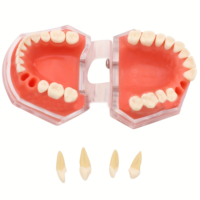 Dental tooth model, soft gum model, removable model, removable model ...