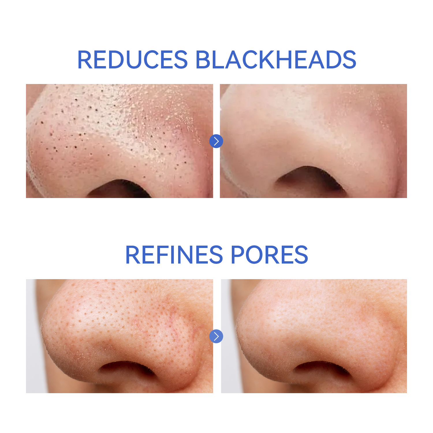 Dr.Leo White Clay Mask Black Heads Removel Deep Cleansing & Purifying ...