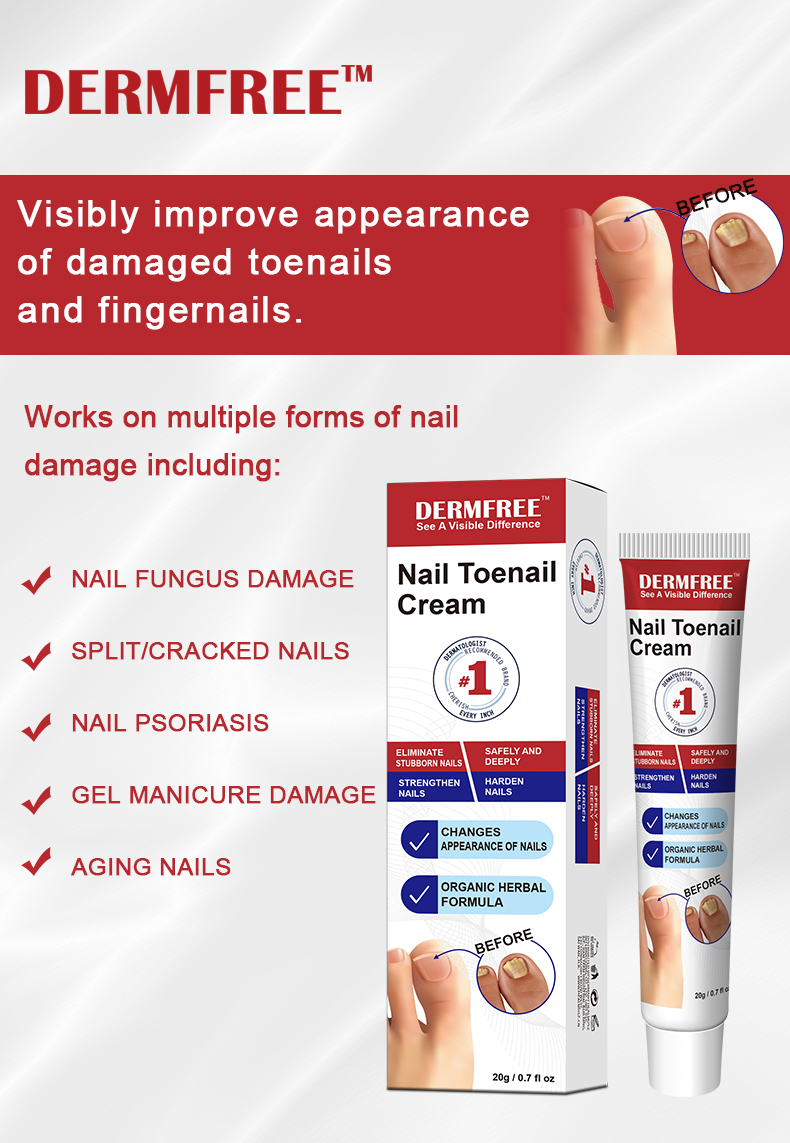 DERMFREE Anti Paronychia Relief Oil Ingrown Toenail Anti Fungal Toe ...