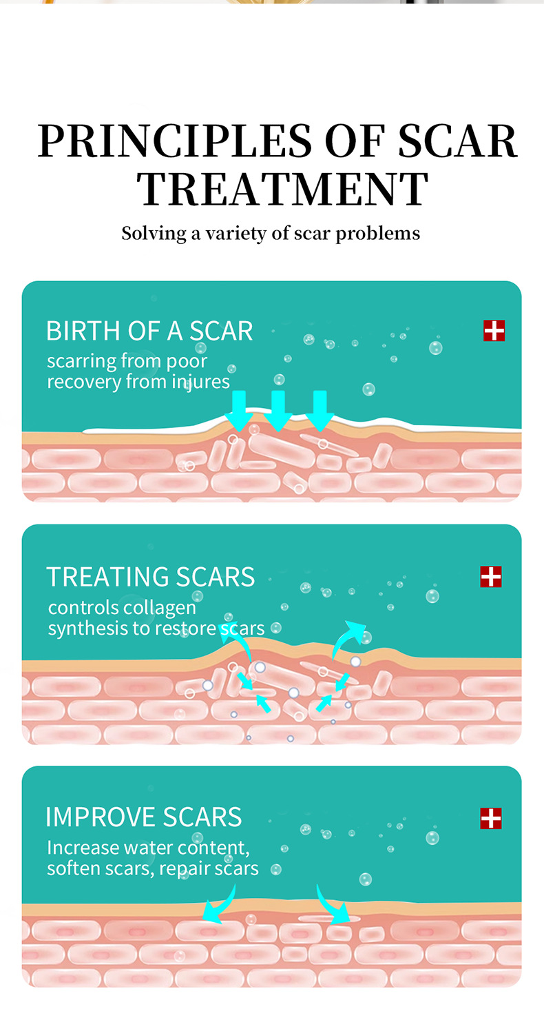 Scar cream acne marks burns post-surgery scar reduction stretch marks ...