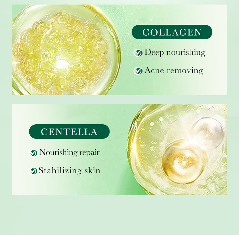 SADOER 3% Salicylic Acid Acne Treatment Serum Pimple Remover Anti Acne Marks Oil Control 30ml ...