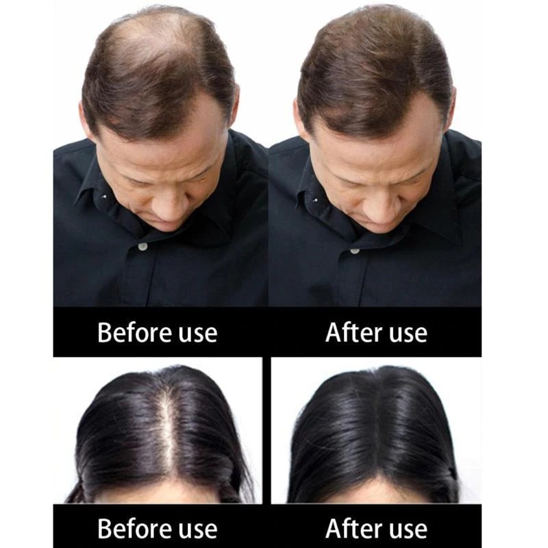 Toppik Keratin Hair Building Fibers Powder Thickening Spray Hair Fibers ...