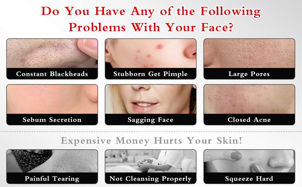 Blackhead Removal Shovel Facial Acne Removal Shovel Beauty Tool Skin ...