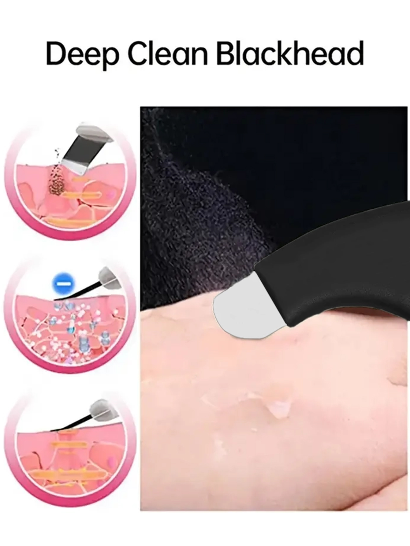 Blackhead Removal Shovel Facial Acne Removal Shovel Beauty Tool Skin ...