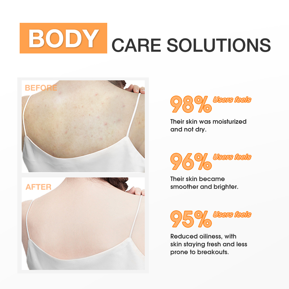 SKINEVER Salicylic Acid Exfoliating Body Niacinamide Body Sunscreen ...