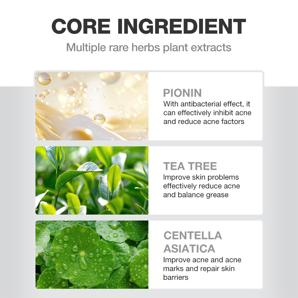 SKINEVER Salicylic Acid Acne Treatment Masque Acne Relief Soothing and ...